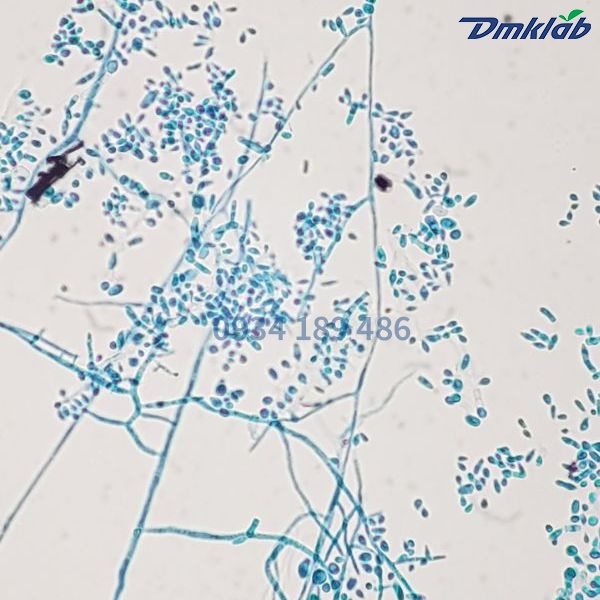 Tiêu bản nấm Trichophyton rubrum