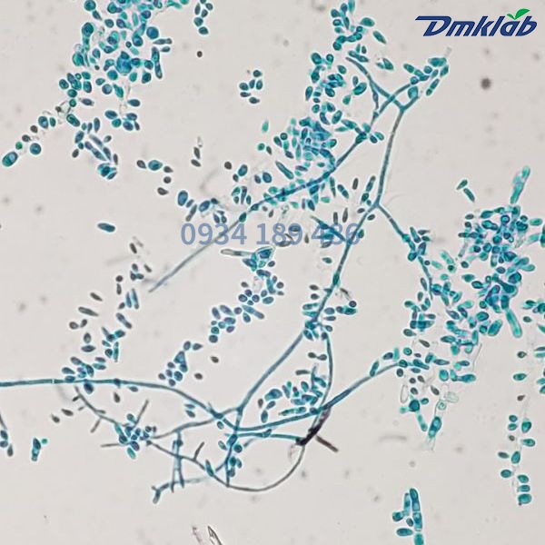 Tiêu bản nấm Trichophyton rubrum